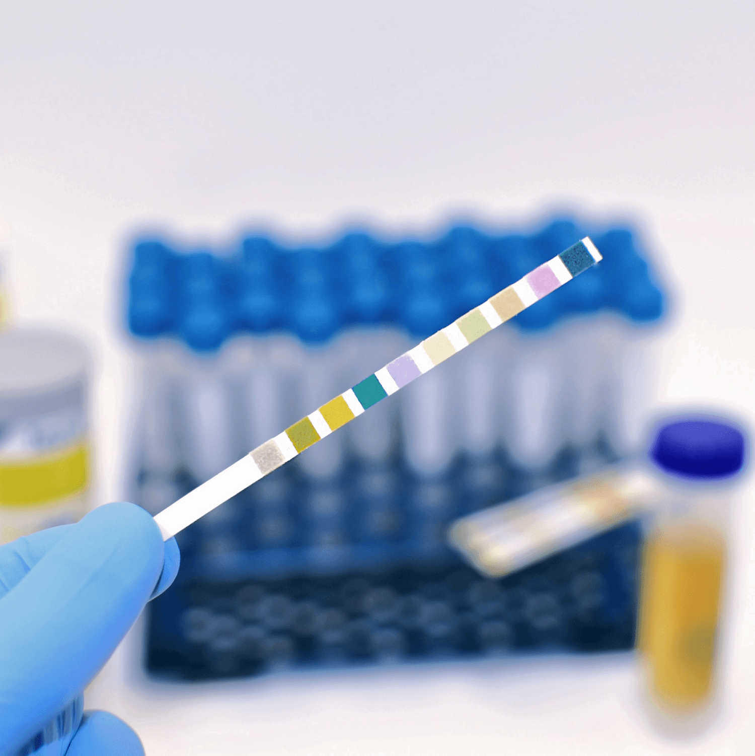 Test-it 10 - Full Panel Urinalysis Test Strips – Homedoc